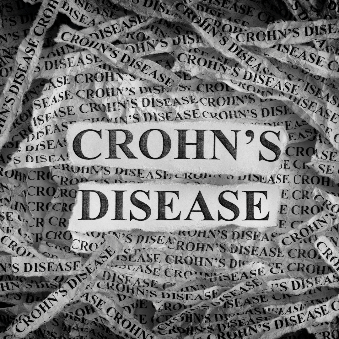 crohn s disease treatment using stem cell therapy crohn s disease treatment using stem cell therapy